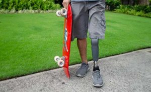 Home - Advanced Prosthetic & Orthotics of the PacificAdvanced ...